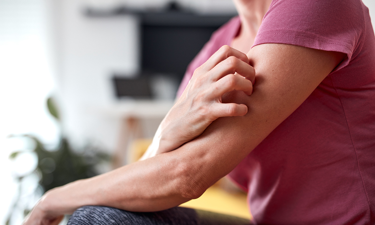 Quando preoccuarsi per il prurito - SapereSalute