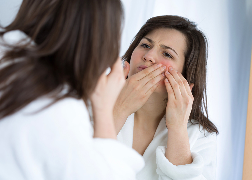 Acne rosacea: ecco i trattamenti disponibili - SapereSalute